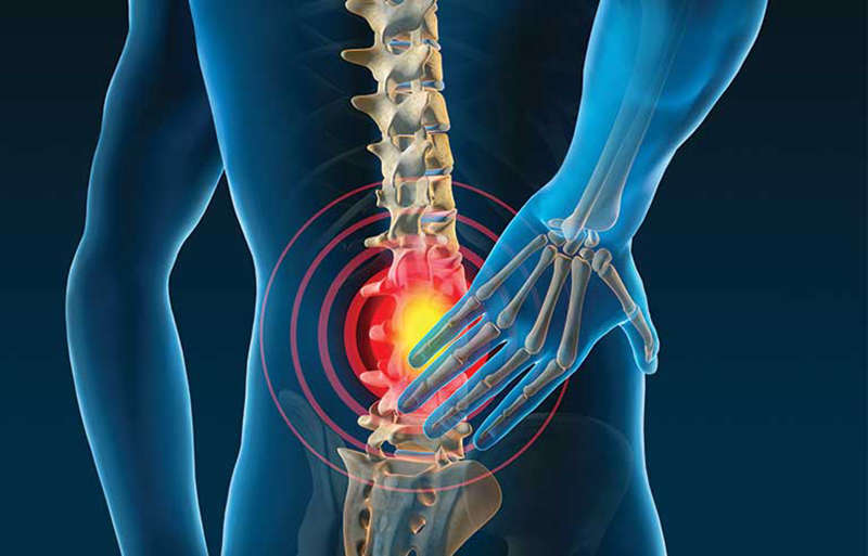 Chronic Low Back Pain Case Study chronic-low-back-pain-case-study