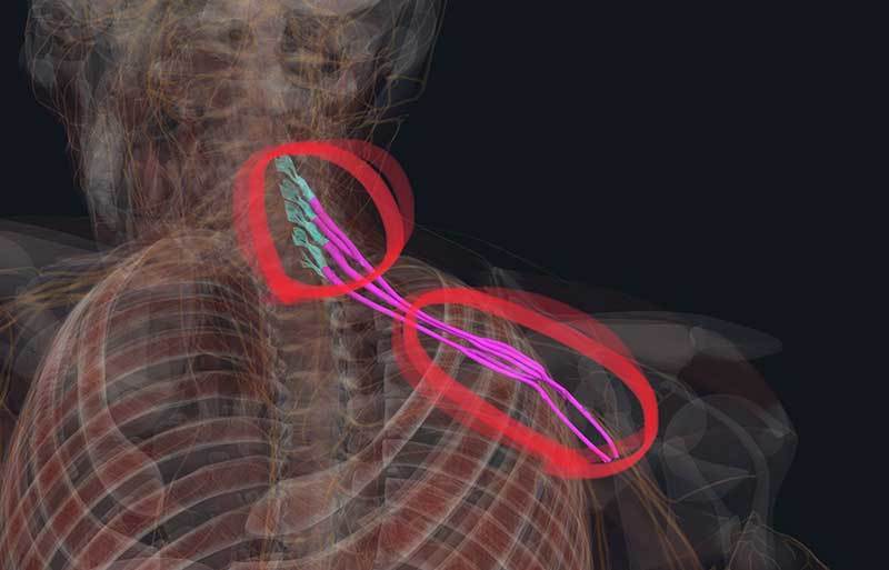 The Nerve Problem You Didn’t Know You Had